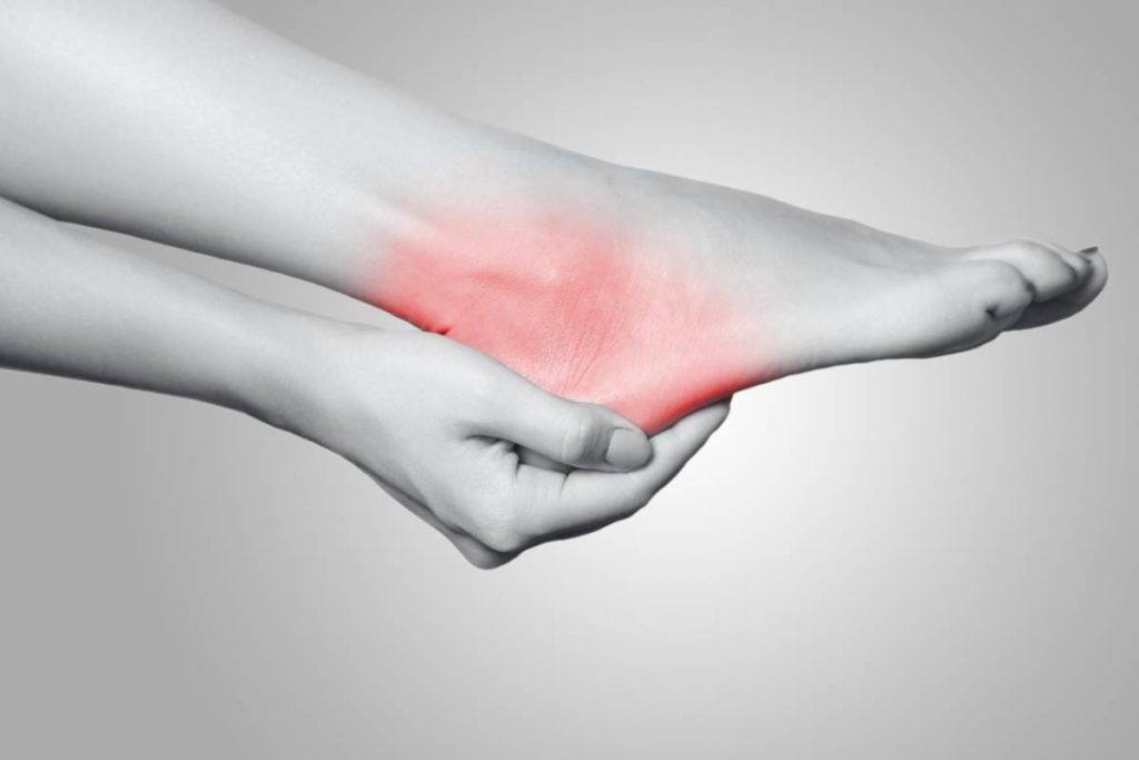 Types of Heel Spurs - Heel Institute of California - Blog